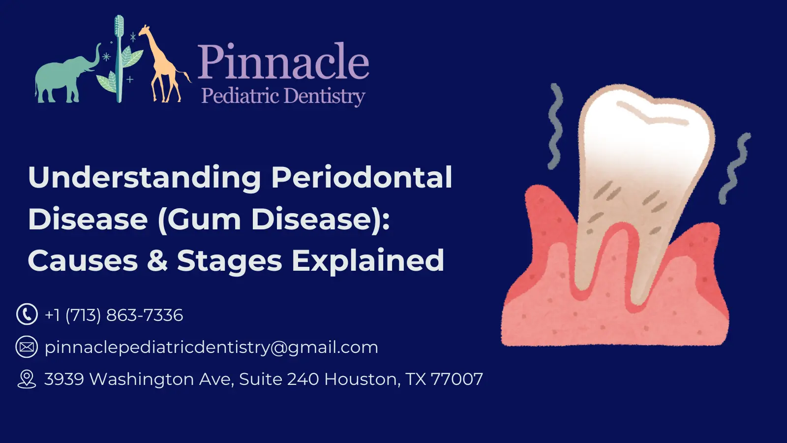 Periodontal Disease (Gum Disease): Causes & Stages