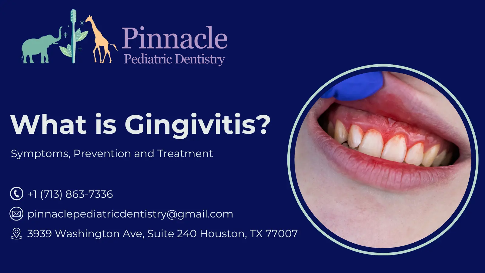 Gingivitis: Symptoms, Prevention and Treatment - Pinnacle Pediatric ...